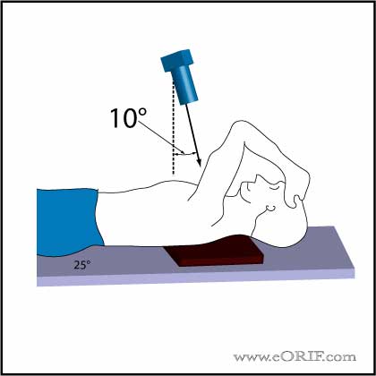 Shoulder Xray | eORIF
